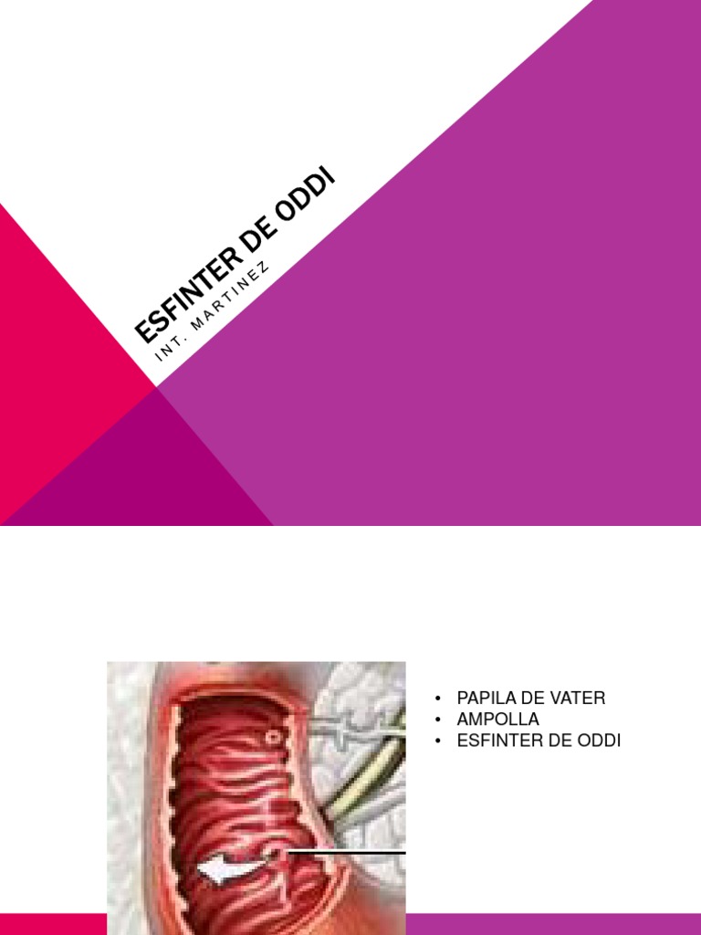 Esfinter de Oddi | Sistema exocrino | Enfermedades y trastornos