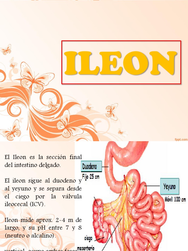 Expo de Ileo | PDF | Abdomen | Intestino grueso
