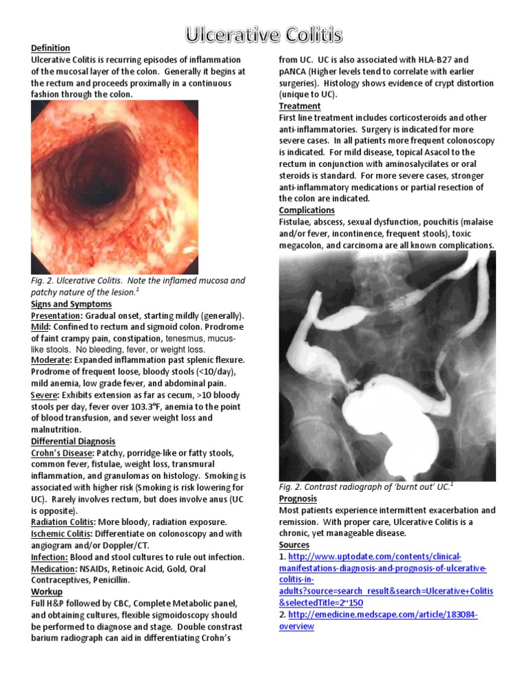 Ulcerative Colitis Handout | PDF