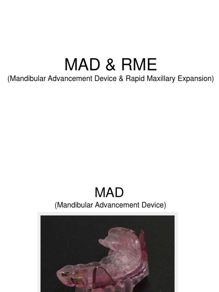 Mandibular Advancement Device & Rapid Maxillary Expansion | PDF ...