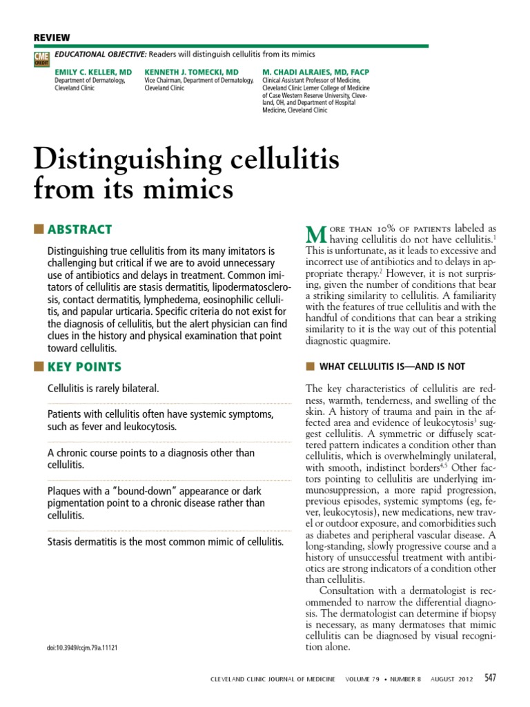CCJM Distinguishing Cellulitis From Its Mimics | PDF