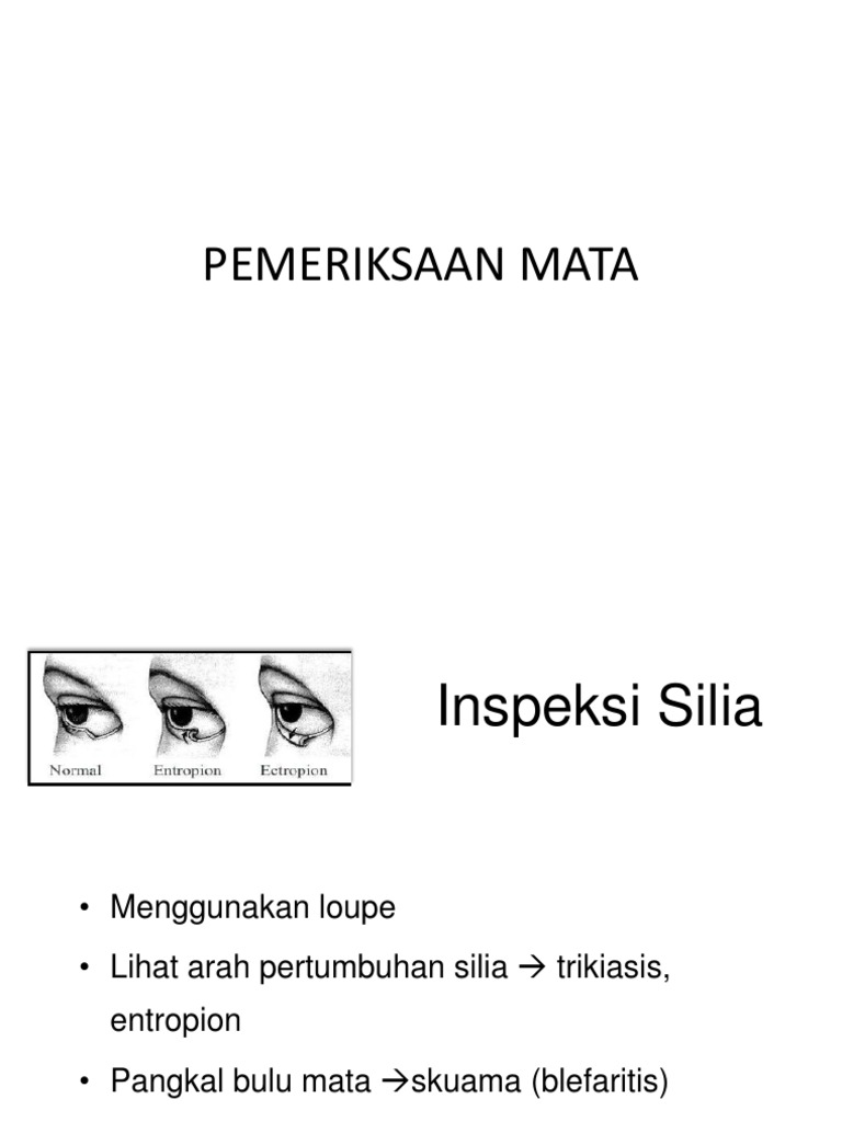 Pemeriksaan Mata: Inspeksi dan Diagnosis | PDF