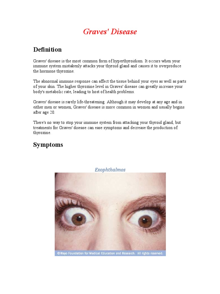 Graves Disease | PDF | Hyperthyroidism | Thyroid Stimulating Hormone