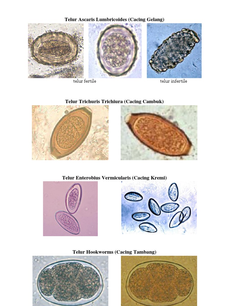 Pemeriksaan Telur Cacing | PDF