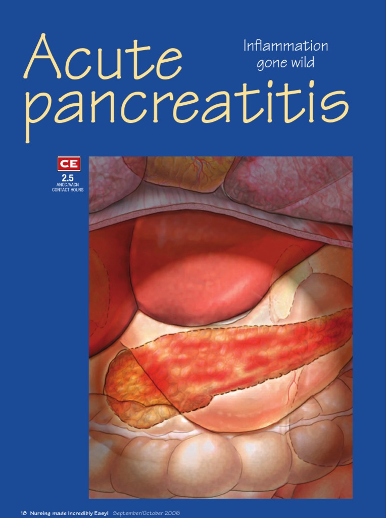acute pancreatitis | Pancreas | Medical Specialties