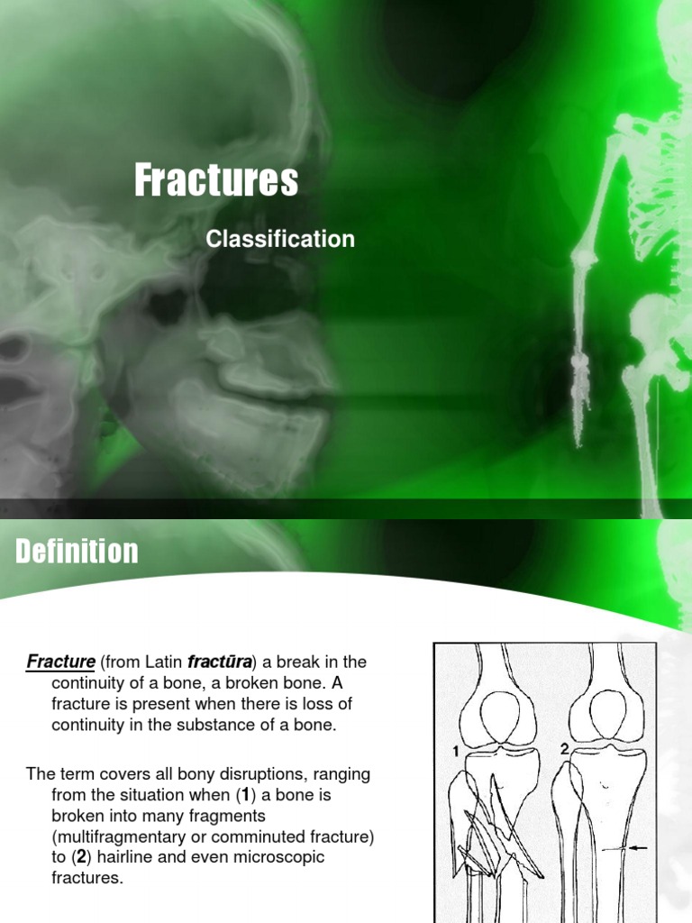 Fractures | PDF | Anatomical Terms Of Location | Bone