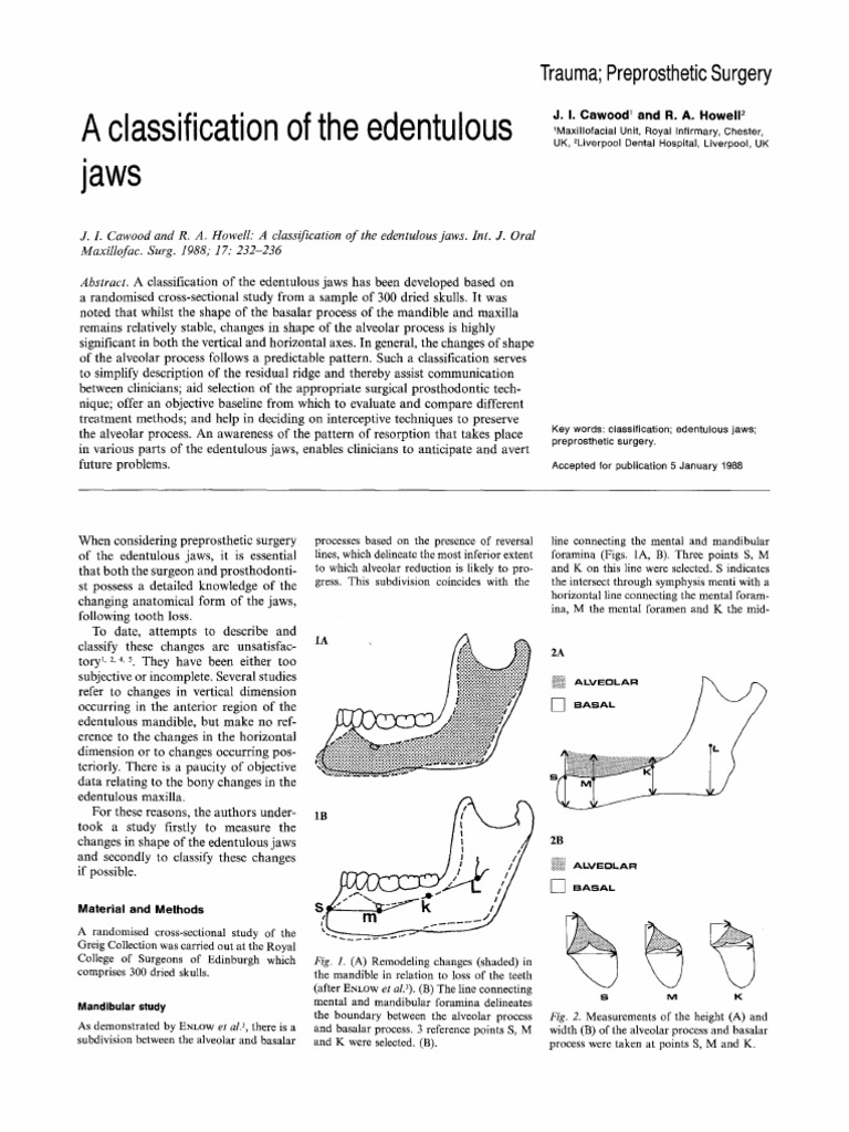 edentulous jaws- classification | Human Head And Neck | Human Anatomy
