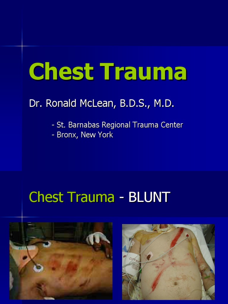 Chest Trauma3 | Thorax | Major Trauma