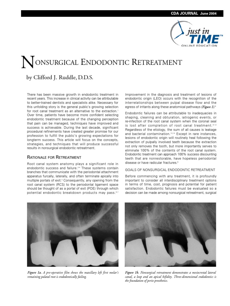 Endodontic Retreatment | PDF | Mouth | Dentistry