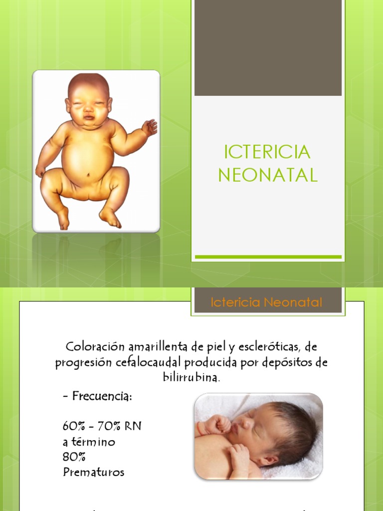 Ictericia Neonatal | PDF | Especialidades Medicas | Enfermedades y trastornos
