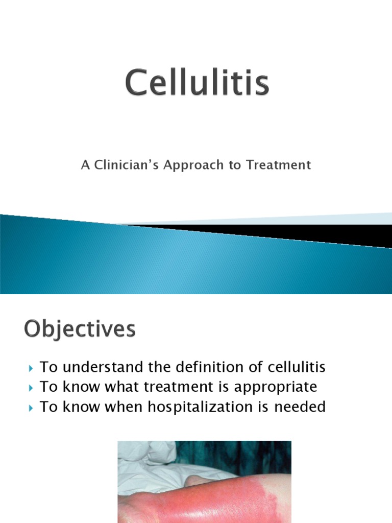 Cellulitis | Methicillin Resistant Staphylococcus Aureus | Epidemiology