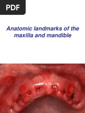 Retromylohyoid Space