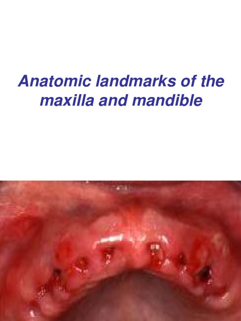 Anatomic Landmarks of The Maxilla and Mandible | PDF | Dentures | Mouth
