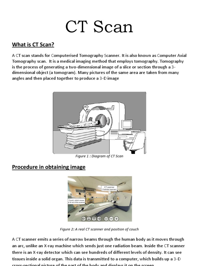 What Is CT Scan? | PDF