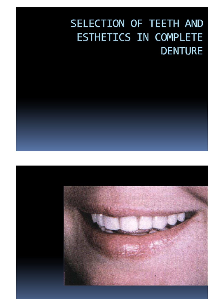 Selection of Teeth and Esthetics in Complete Denture | Dentures | Tooth