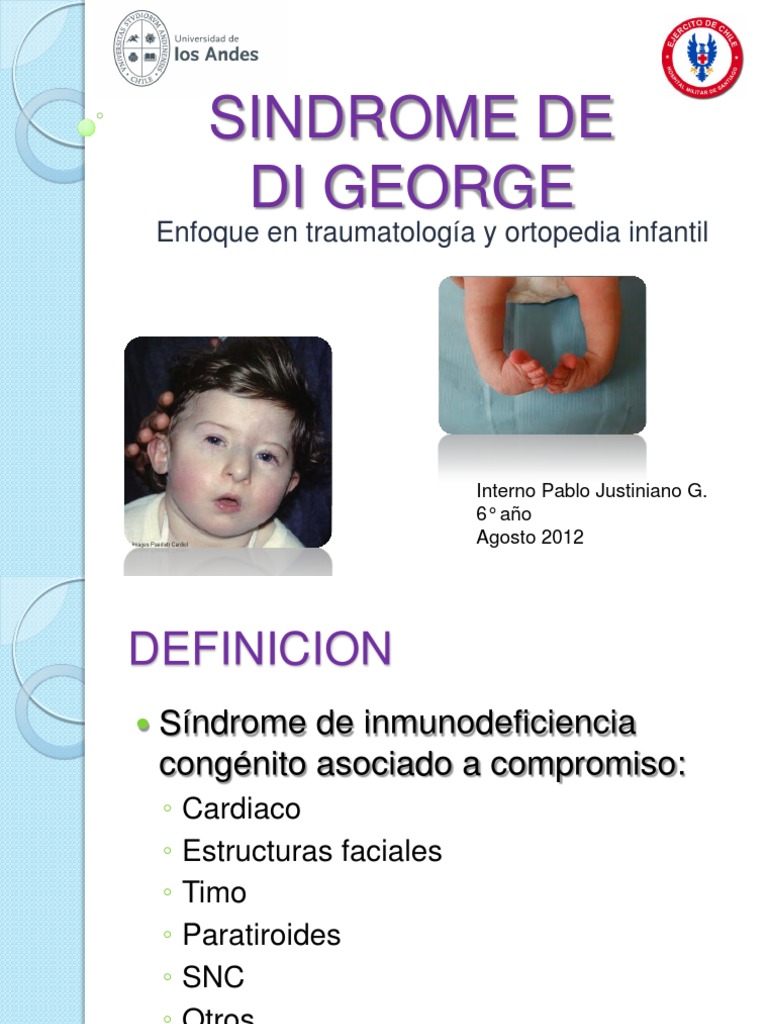 Sindrome de Digeorge | PDF | Especialidades Medicas | Medicina CLINICA
