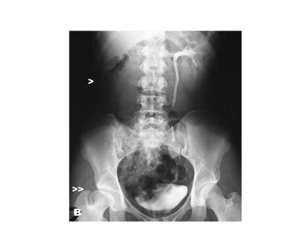 Pediatric Surgery X Rays | PDF