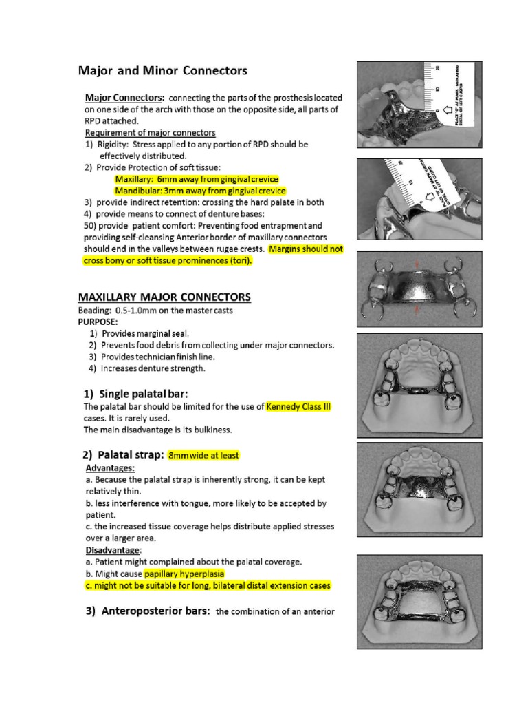 Major and Minor Connectors | PDF | Dentures | Human Tooth