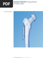 Endobutton CL Ultra TECNICA v2 | PDF | Extremidades (anatomía ...