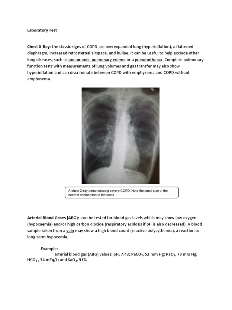 Laboratory Test COPD | PDF