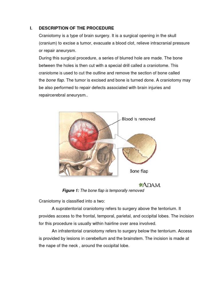 Craniotomy case report | Angiography | Surgery