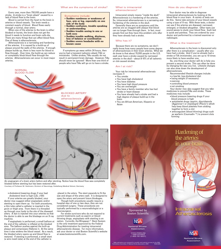 A Stroke Recovery | PDF | Stroke | Atherosclerosis