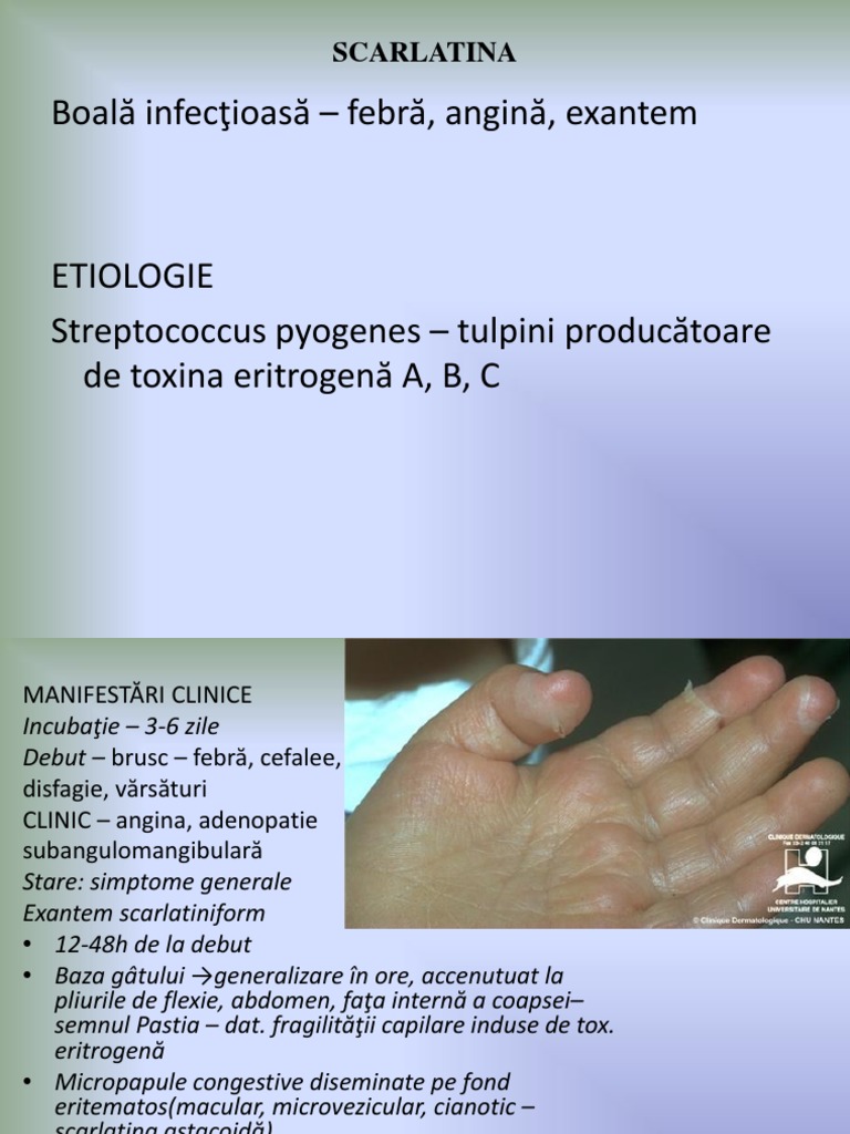 Scarlatina | PDF