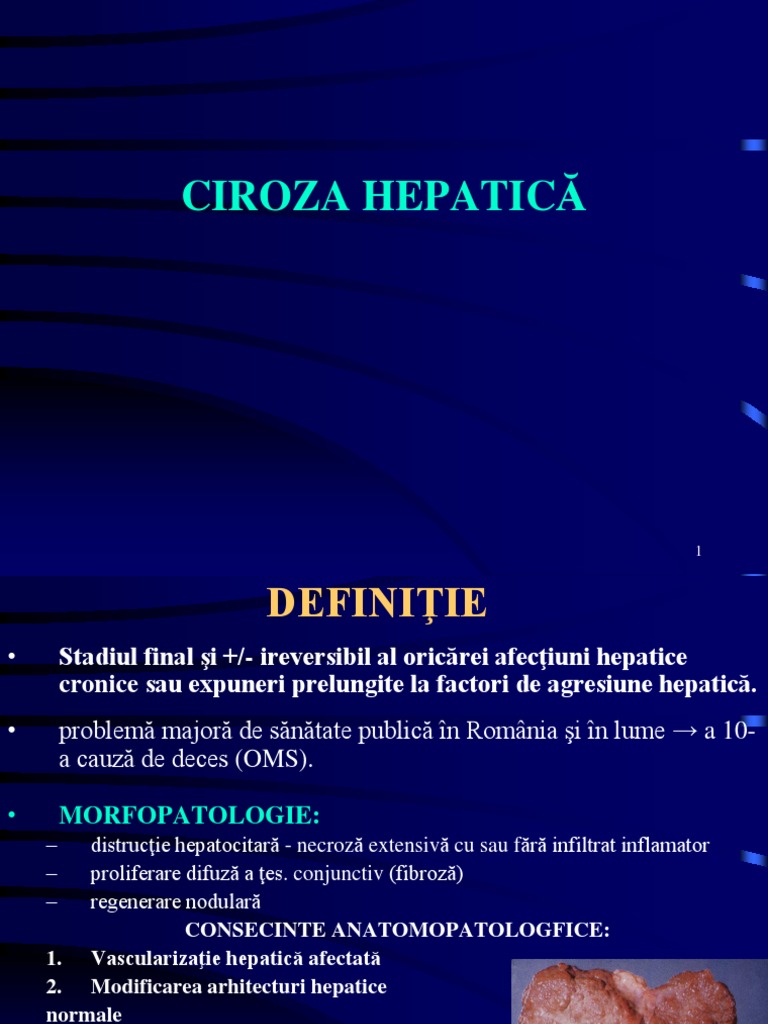 Ciroza Hepatica | PDF