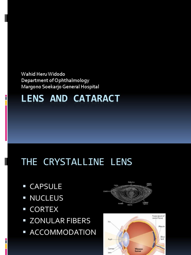 Lens and Cataract: Wahid Heru Widodo Department of Ophthalmology ...