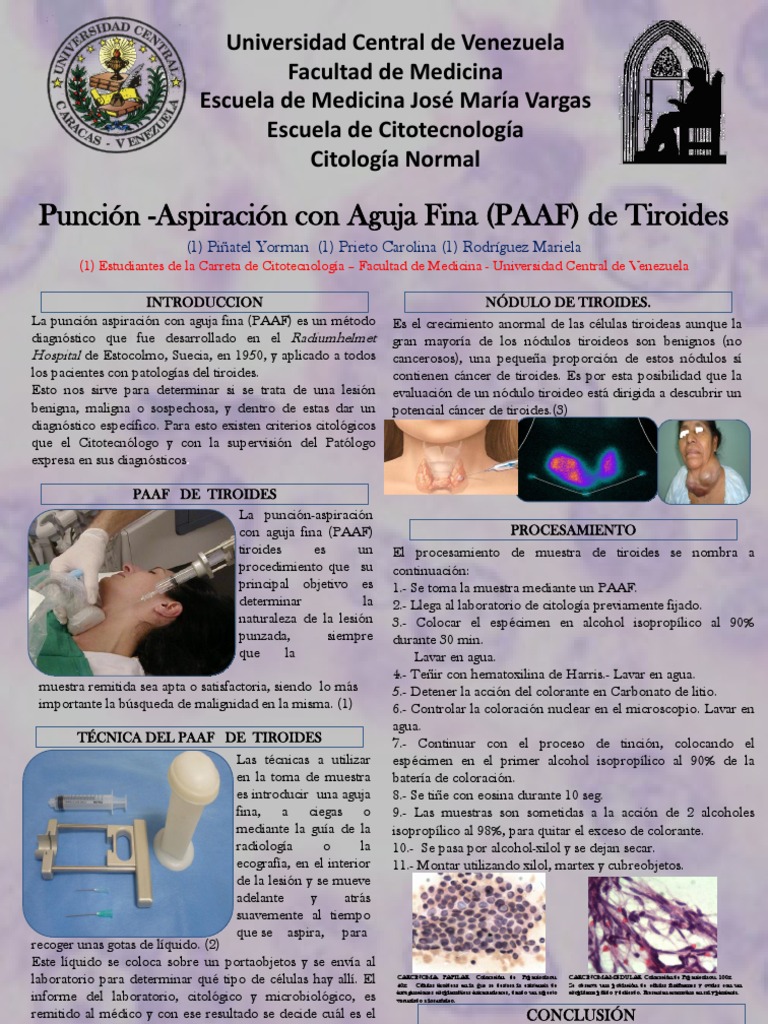 Poster PAAF Tiroides | PDF | Cáncer | Medicina CLINICA