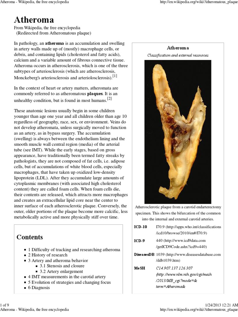 Atheroma - Wikipedia, The Free Encyclopedia | PDF | Atheroma ...