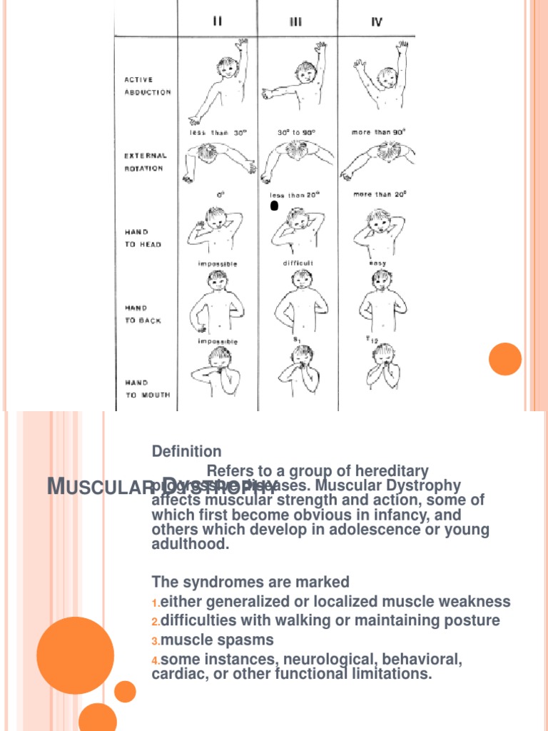 Muscular Dystrophy | PDF | Muscular Dystrophy | Weakness