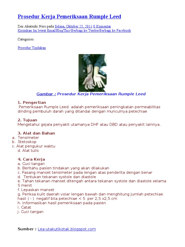 Prosedur Kerja Pemeriksaan Rumple Leed | PDF | Sains & Matematika