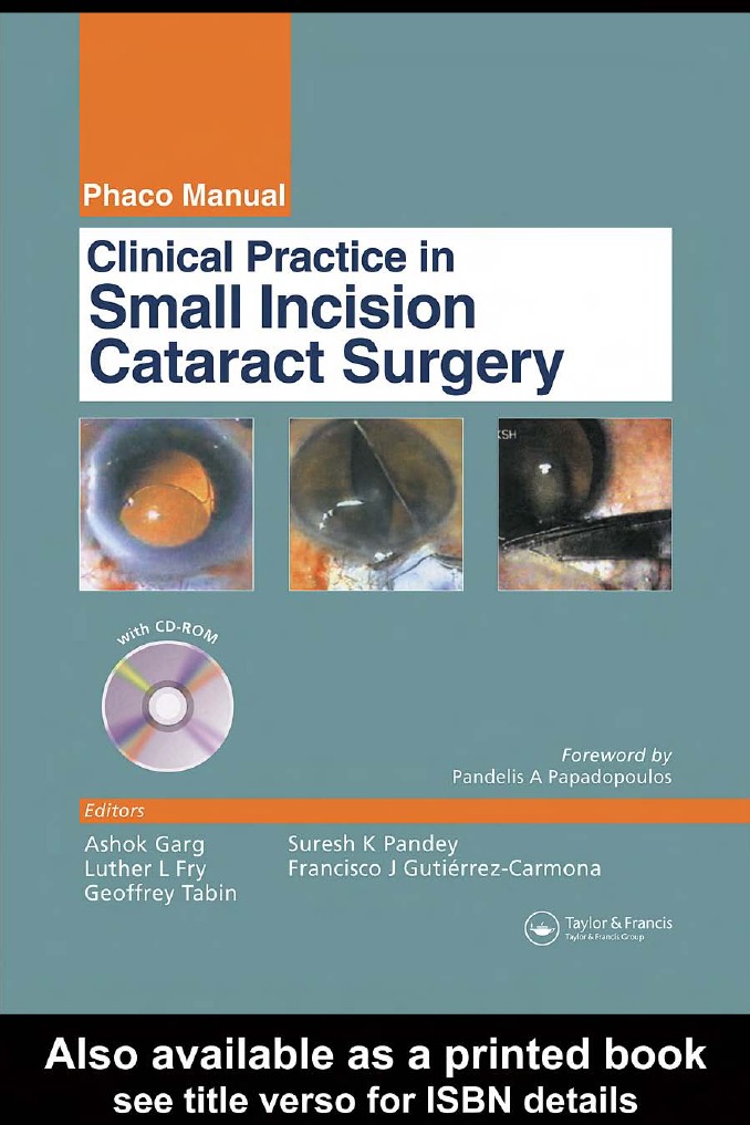 Clinical Practice in Small Incision Cataract Surgery | PDF | Eye | Vision