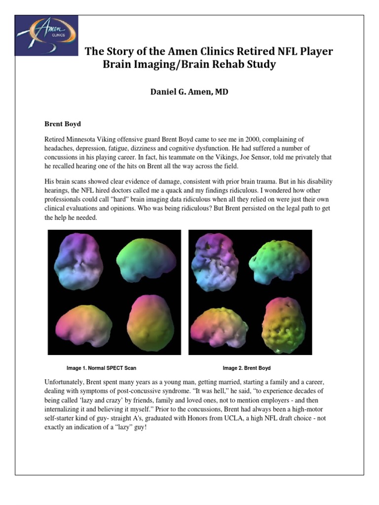 Amen Clinics Retired NFL Players Brain Study | Chronic Traumatic ...