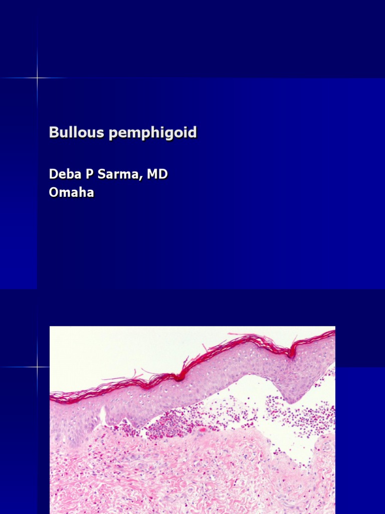 Bullous Disease of The Skin, Bullous Pemphigoid. | PDF