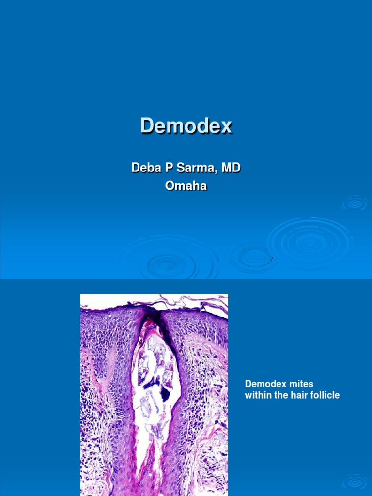 Demodex | PDF