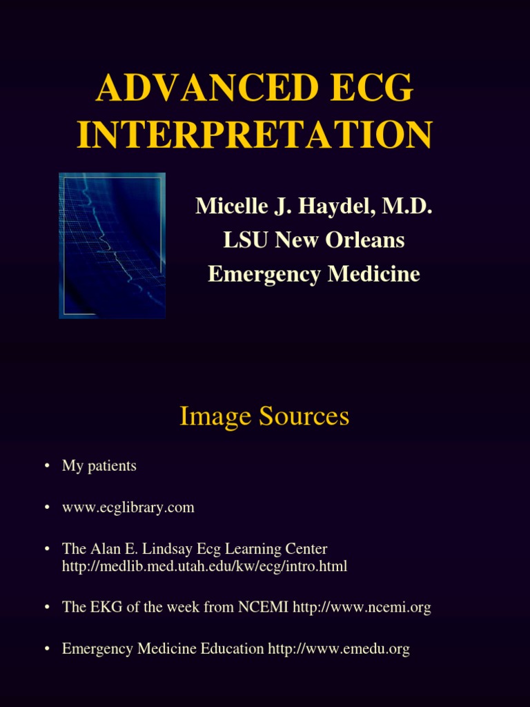 Advanced Ecg Interpretation | PDF | Cardiac Arrhythmia ...