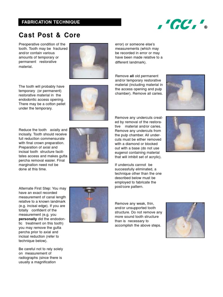 CAST POST | Dentistry | Nature