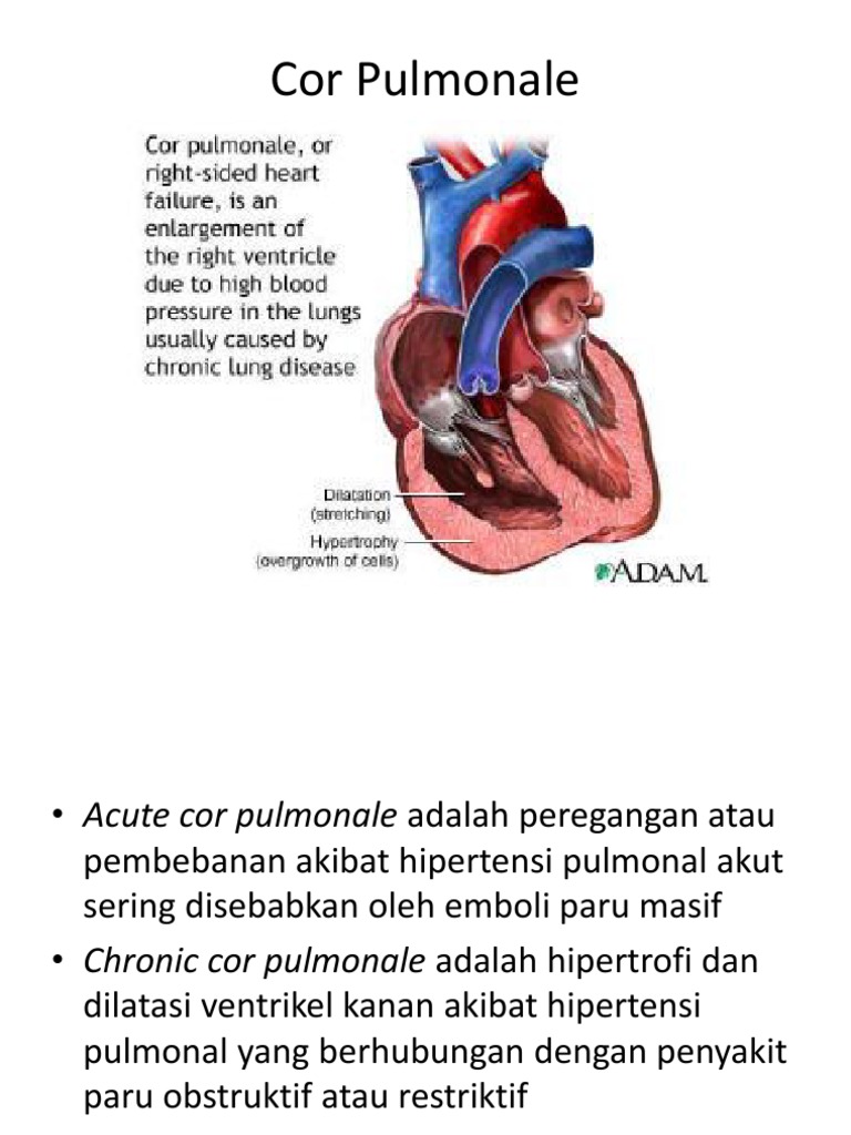 Penyakit Kelainan Jantung Cor Pulmonale 