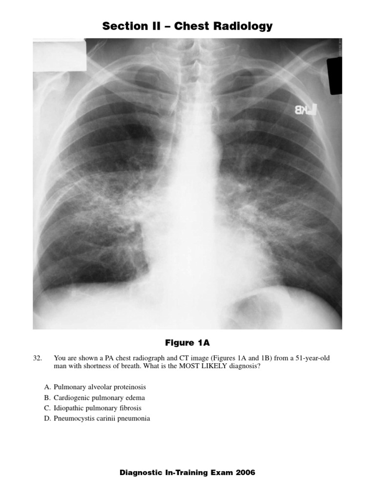 Section II - Chest Radiology: Figure 1A | PDF | Lung | Radiology