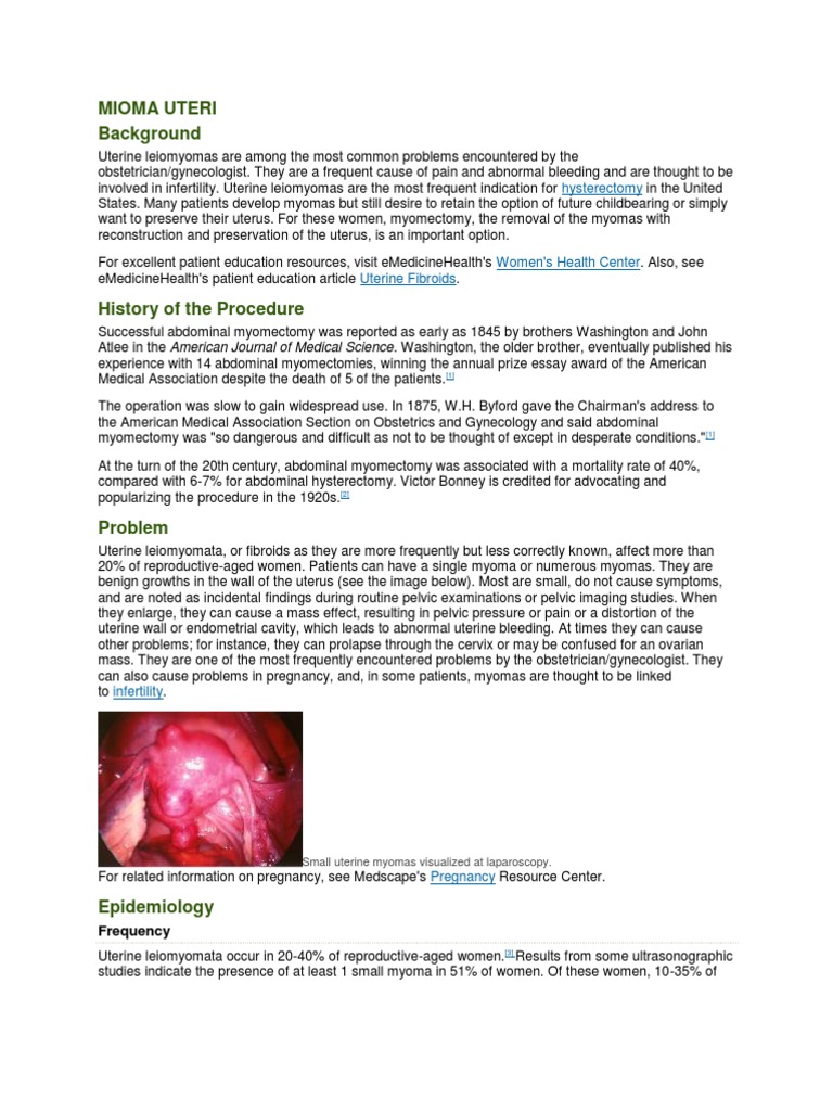 mioma uteri | Uterus | Human Reproduction