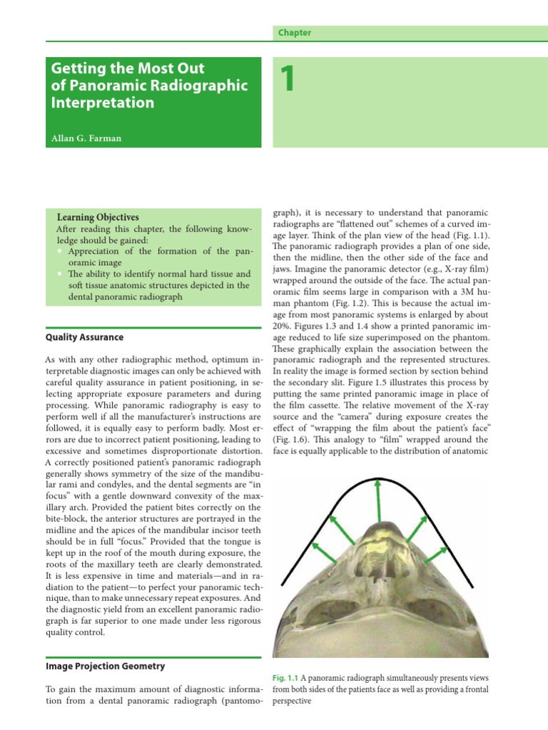 Getting The Most Out of Panoramic Radiographic Interpretation - Allan G ...
