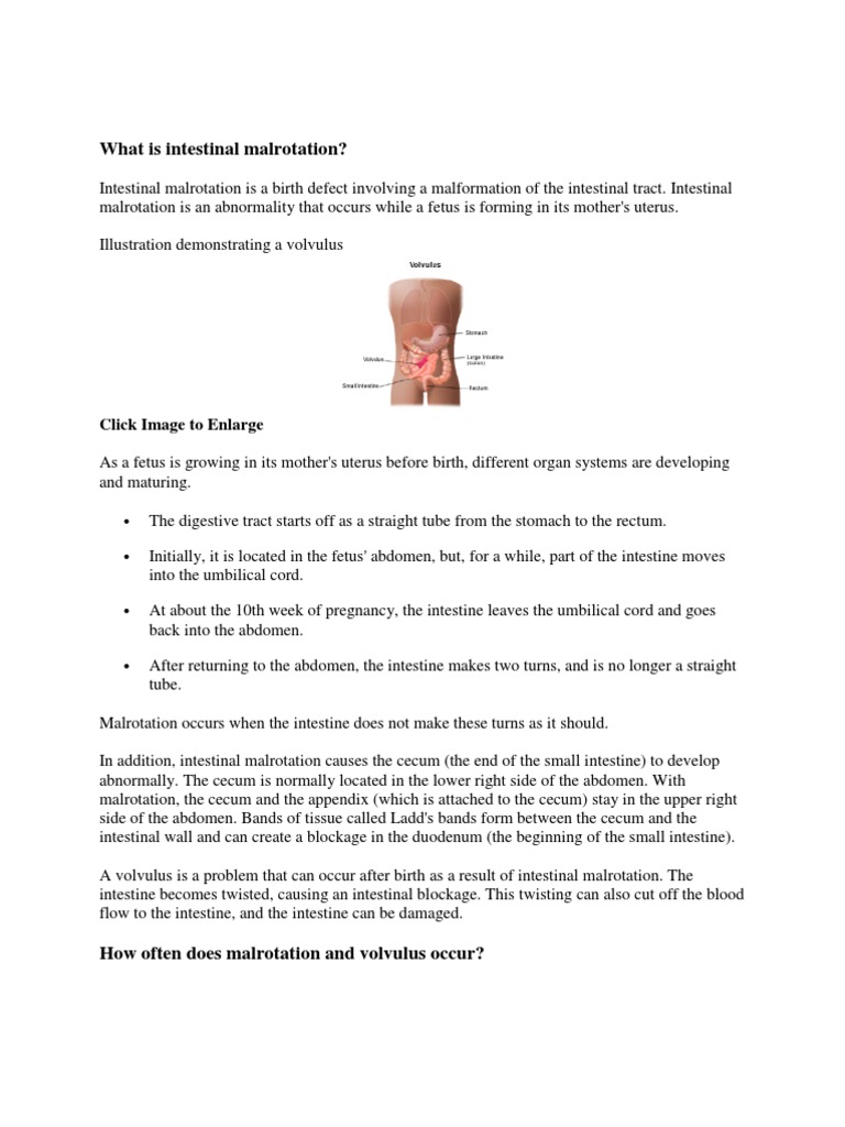 What Is Intestinal Malrotation | PDF | Gastrointestinal Tract | Anatomy
