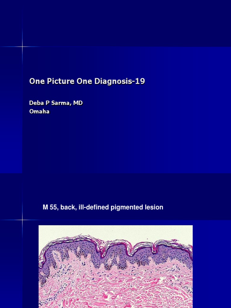 One Picture One Diagnosis-19 (Lentigo Simplex) | PDF