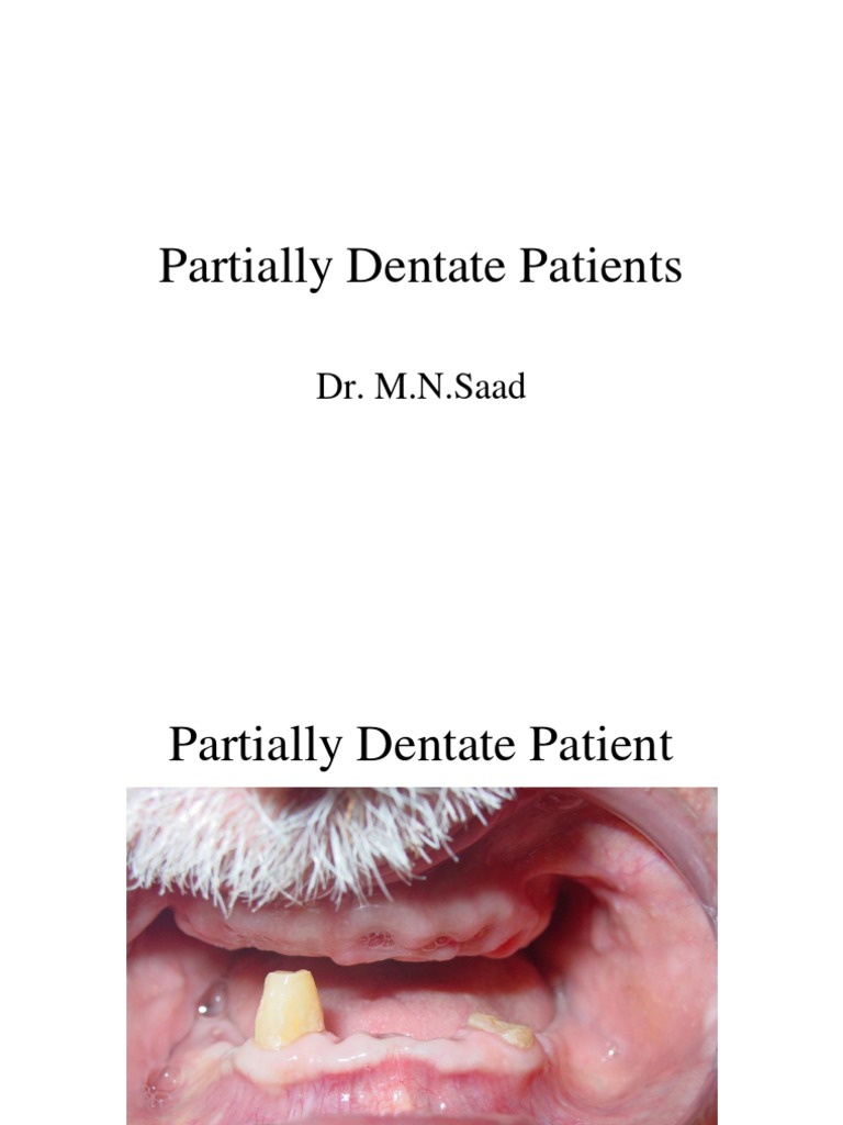 Partially Dentate Patient | Dentures | Medical Diagnosis