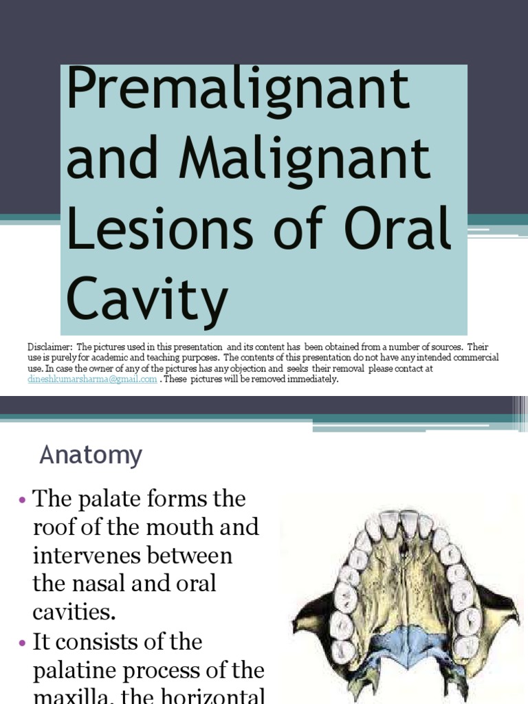 Premalignant Malignant Lesions of Oral Cavity | PDF