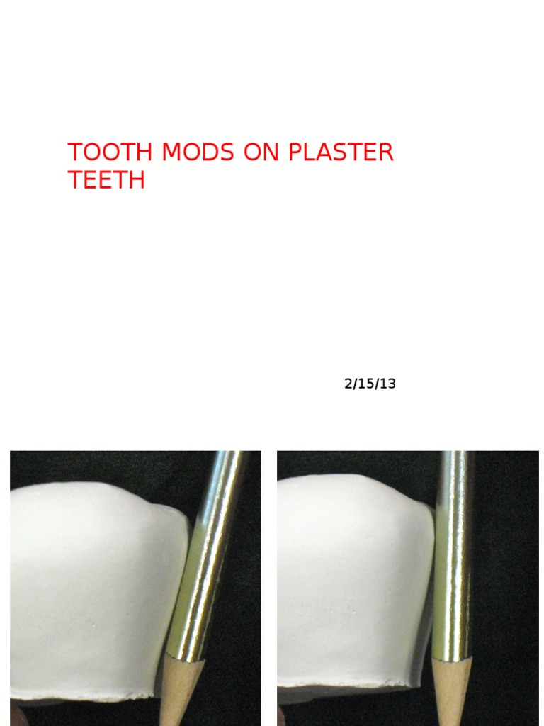 Plaster Tooth Mods | PDF