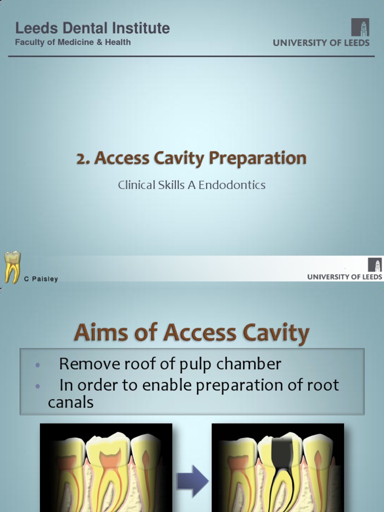 Access Cavity Preparation in Endodontics | PDF | Science & Mathematics