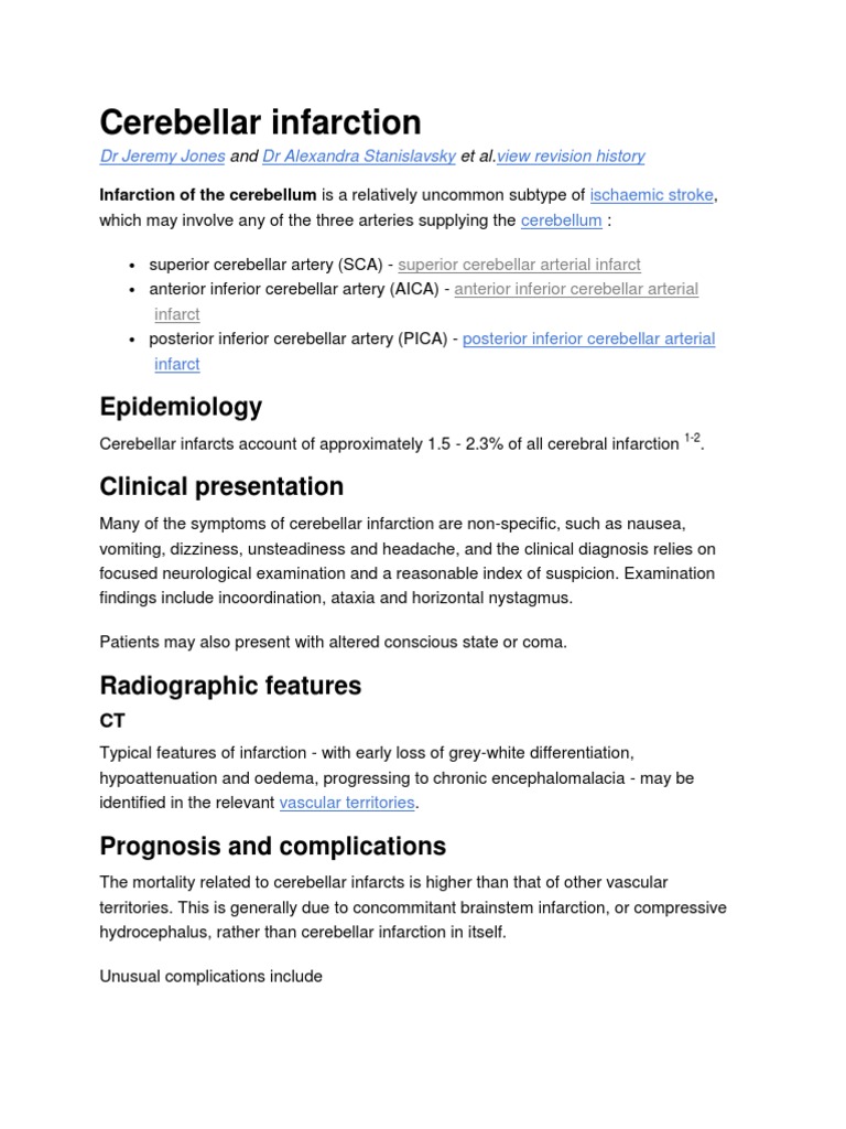Cerebellar Infarction | PDF | Angiography | Vertigo